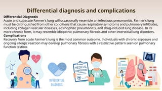 farmers lung etiology diagnosis and treatment -jila.pptx