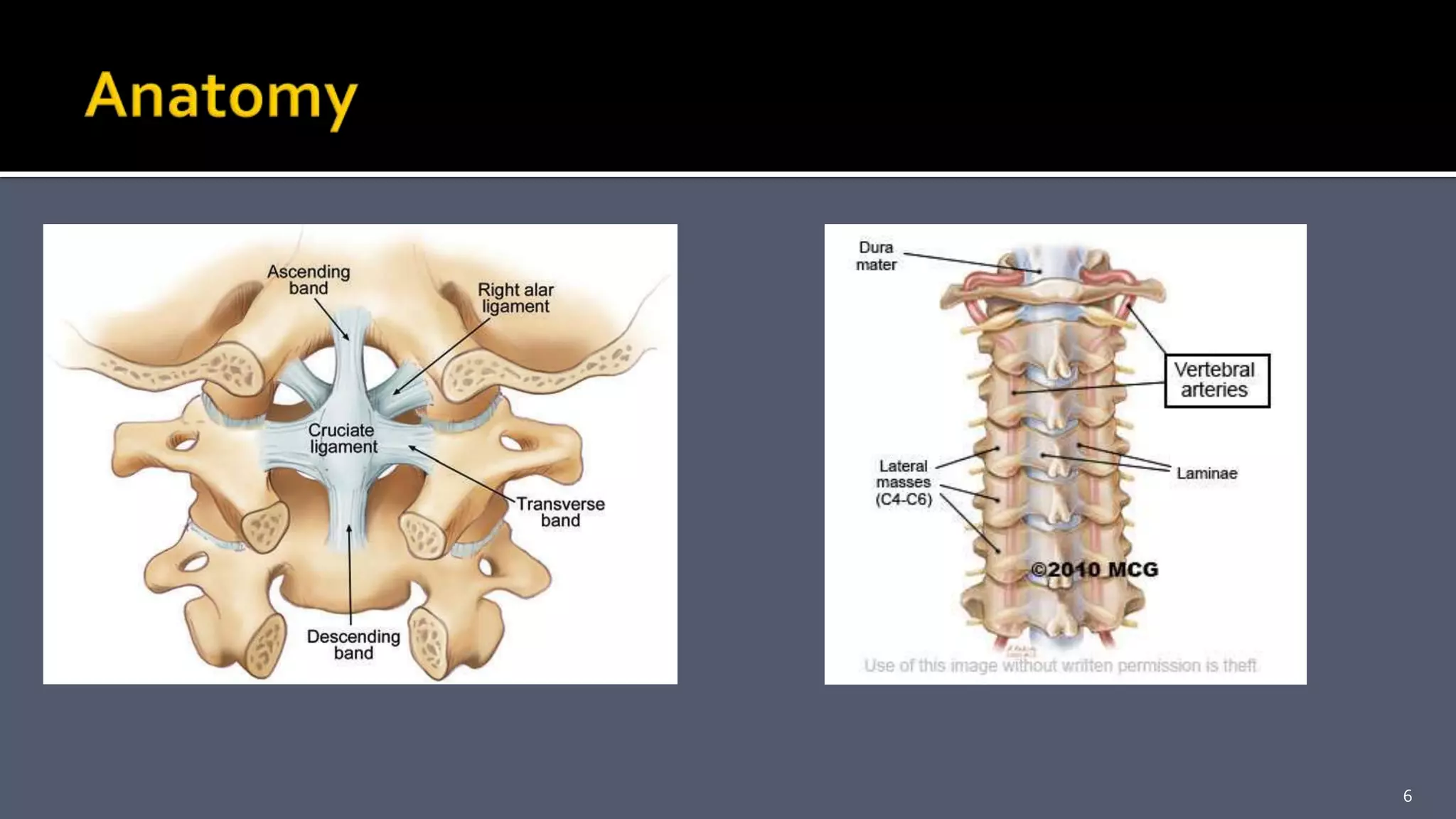 Cervical Fusion C1 C2 Fusion Ppt