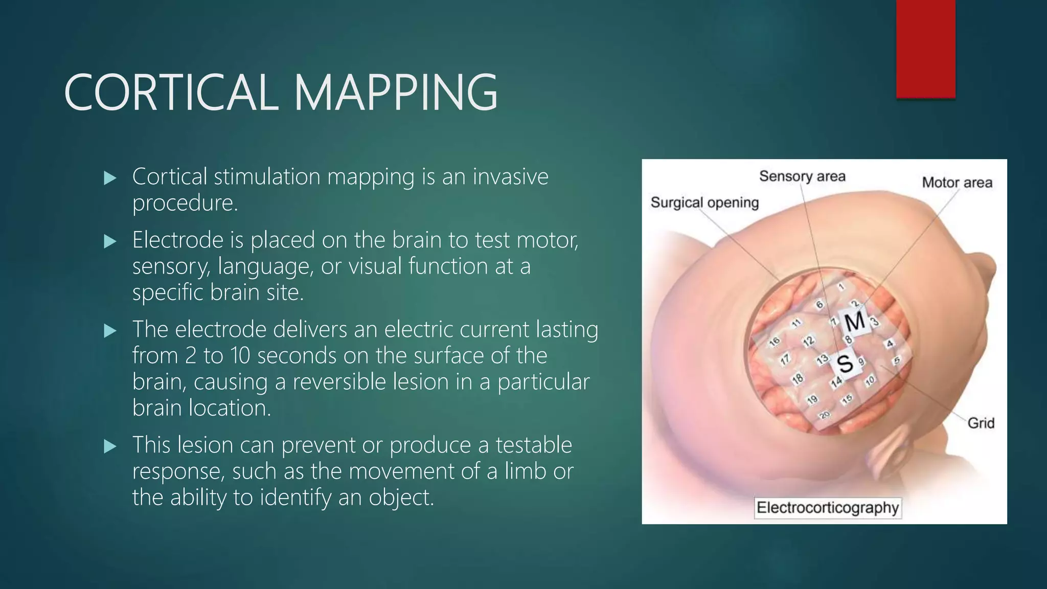 Intraoperative Neurophysiological Monitoring Brain | PPTX