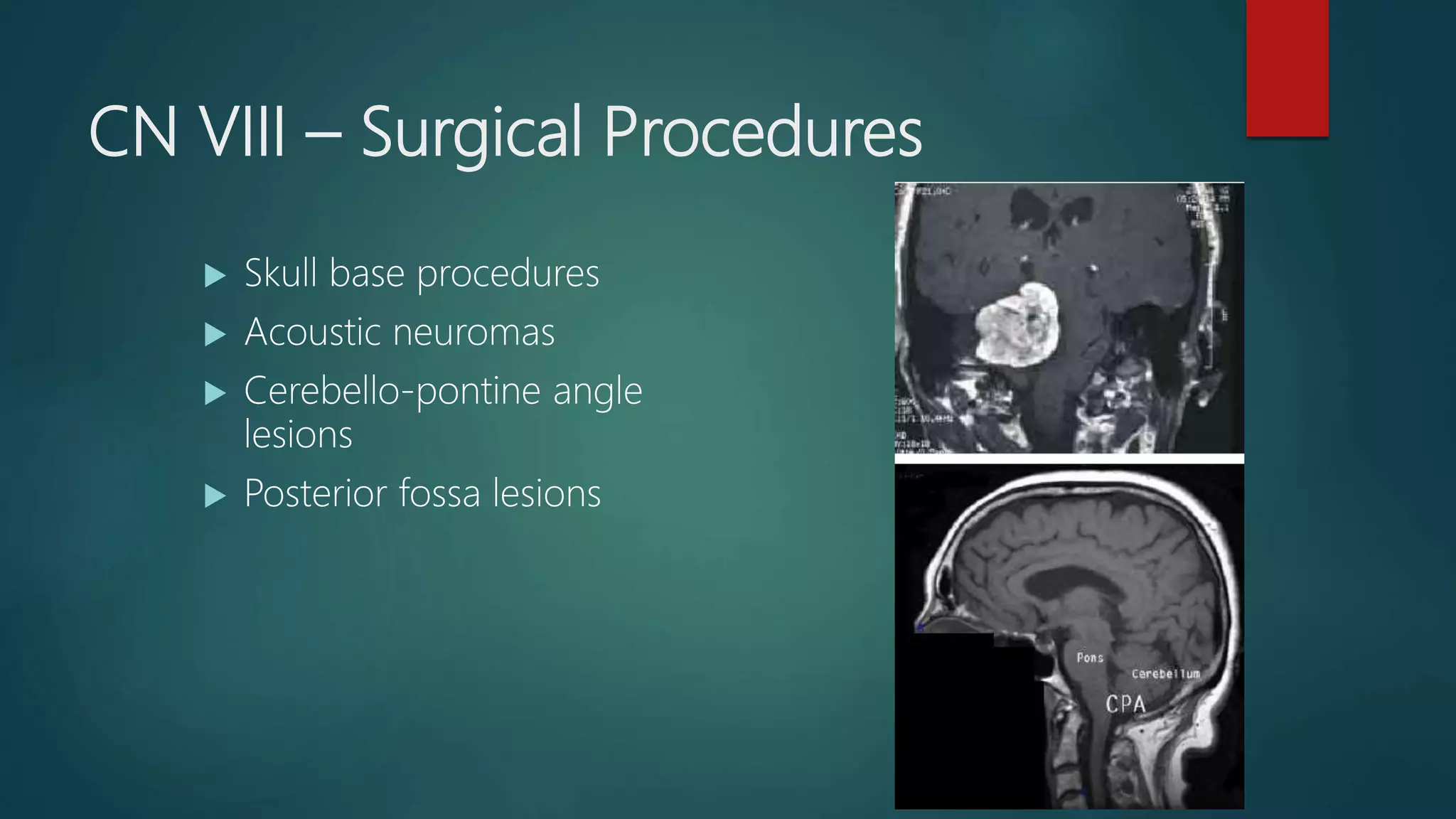 Intraoperative Neurophysiological Monitoring Brain | PPTX
