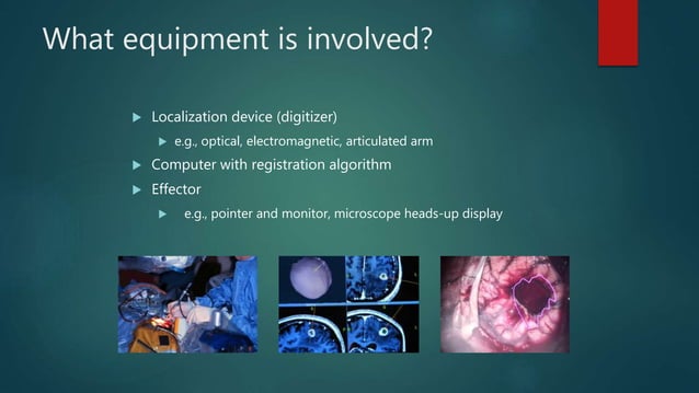 Stereotaxy Brain | PPTX | Brain and Nervous System Disorders | Diseases ...