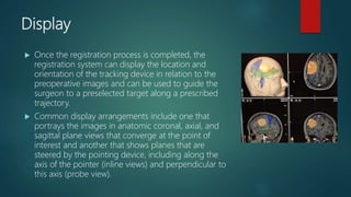 Stereotaxy Brain | PPTX