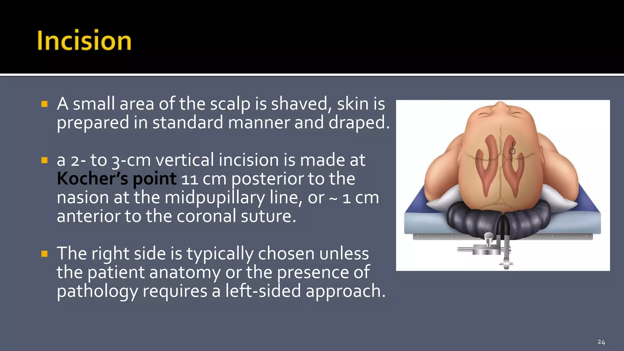 Endoscopic Third Ventriculostomy | PPTX
