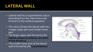 Endoscopic Third Ventriculostomy | PPTX