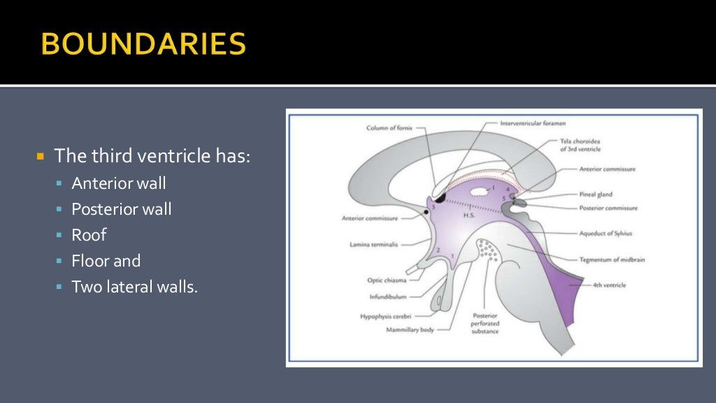 Endoscopic Third Ventriculostomy
