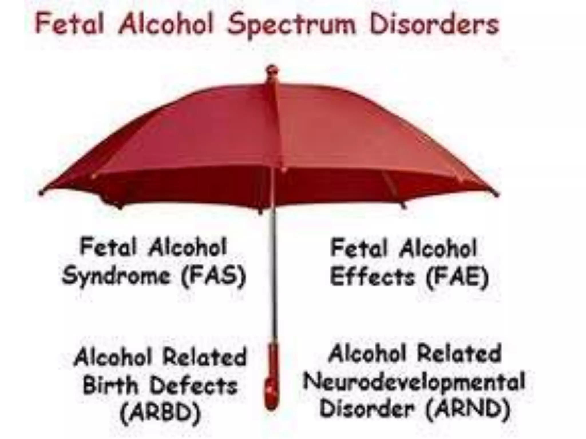 FETAL ALCOHOL SYNDROME(FAS) | PPTX