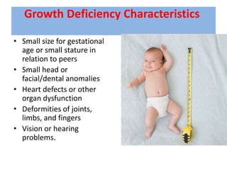 FETAL ALCOHOL SYNDROME(FAS) | PPTX