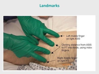 Fascia iliaca block | PPT