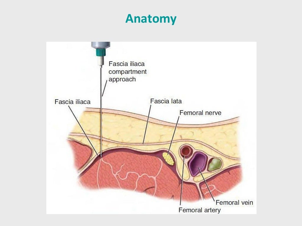 Fascia iliaca block