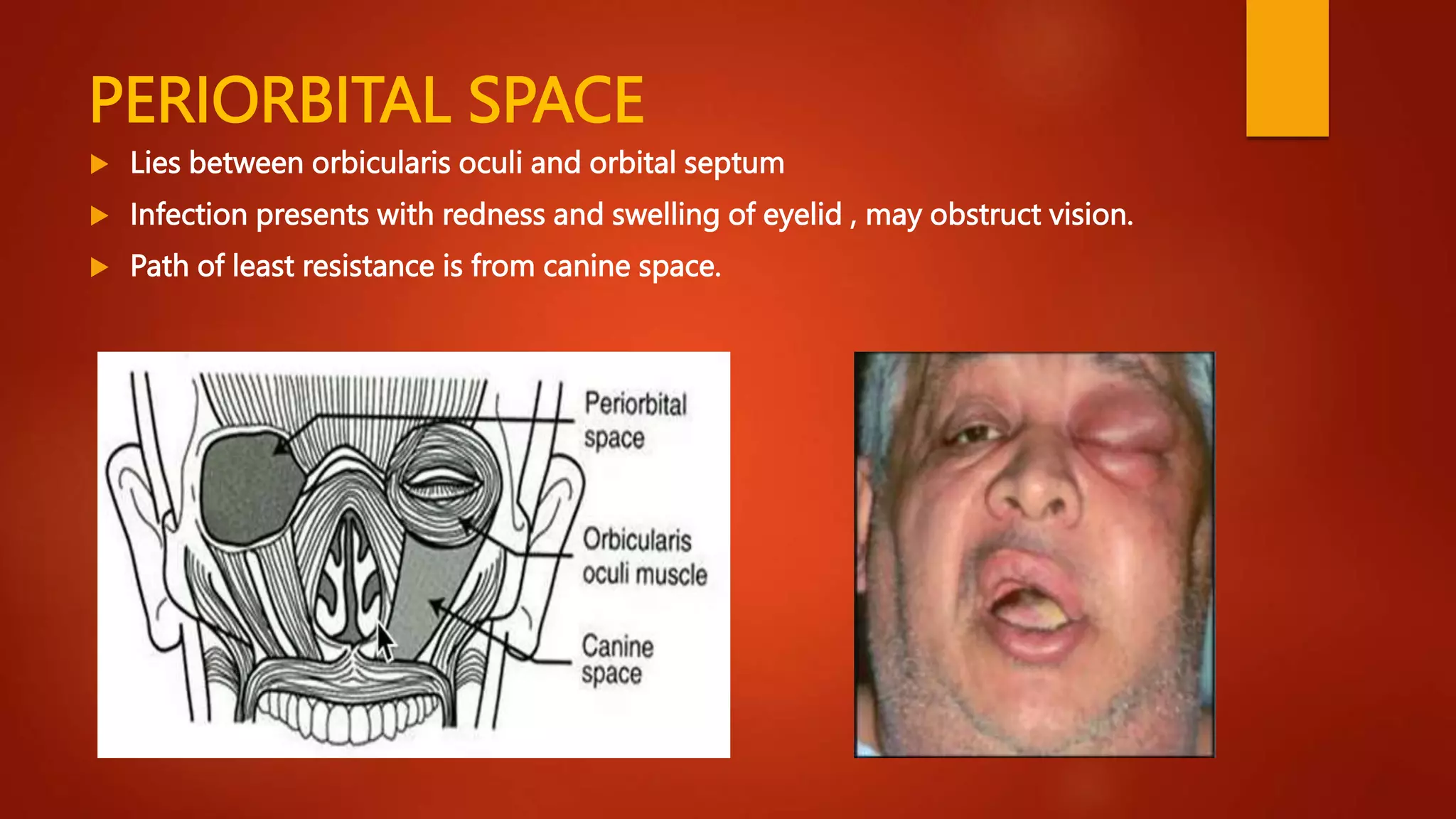 fascial space.pptx