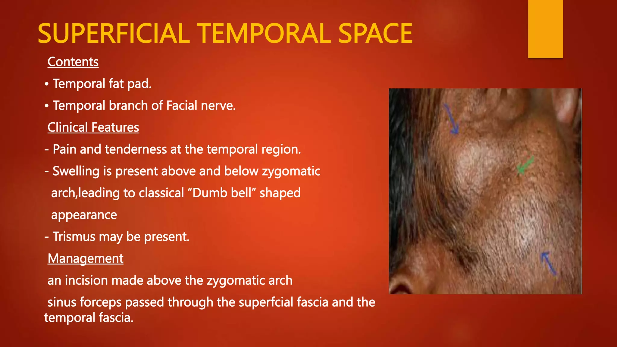 fascial space.pptx