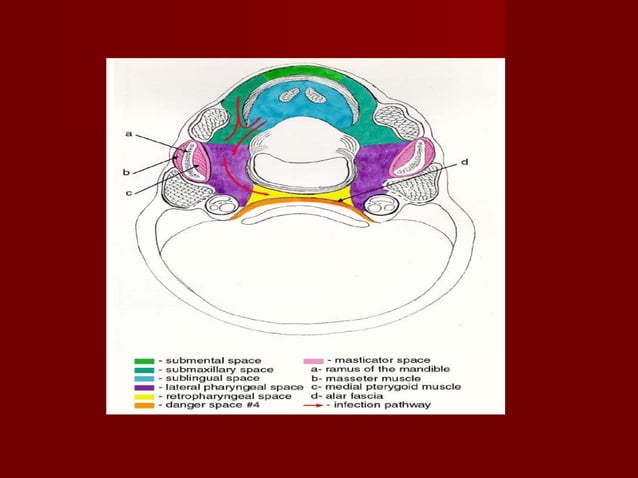 Fascial spaces | PPT | Ear, Nose and Throat Conditions | Diseases and ...