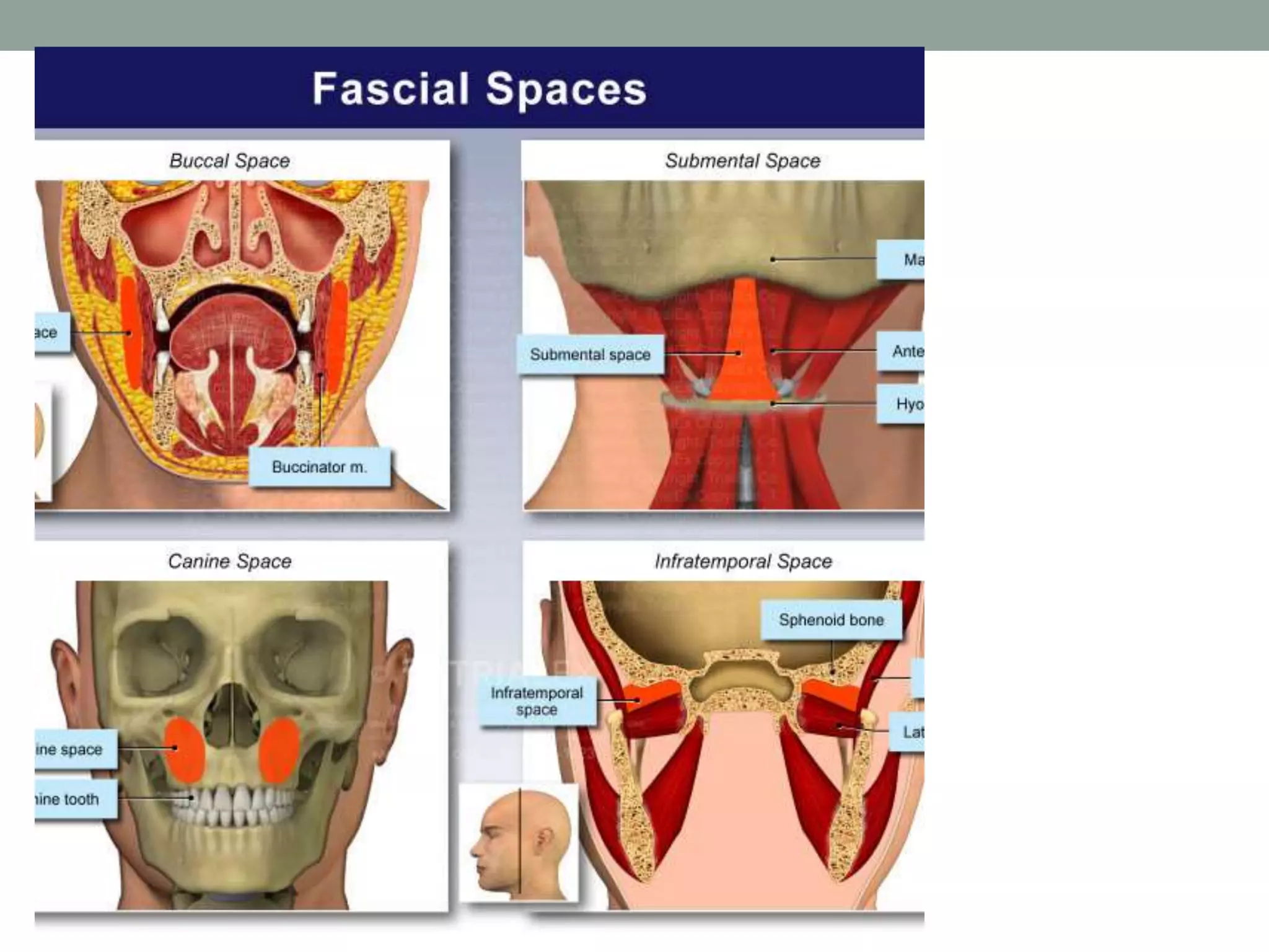 Fascial spaces.pptx | Ear, Nose and Throat Conditions | Diseases and ...