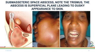 FASCIAL SPACES OF THE HEAD AND NECK ANATOMY AND SURGICAL ACCESS.pptx