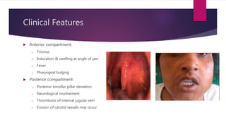 Fascial spaces of the jaws and its management | PPTX