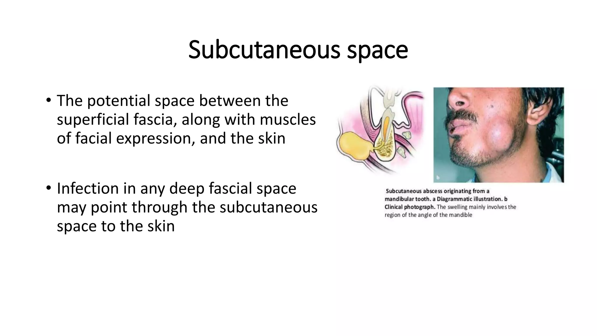 Fascial Spaces in the Head & Neck | PPTX
