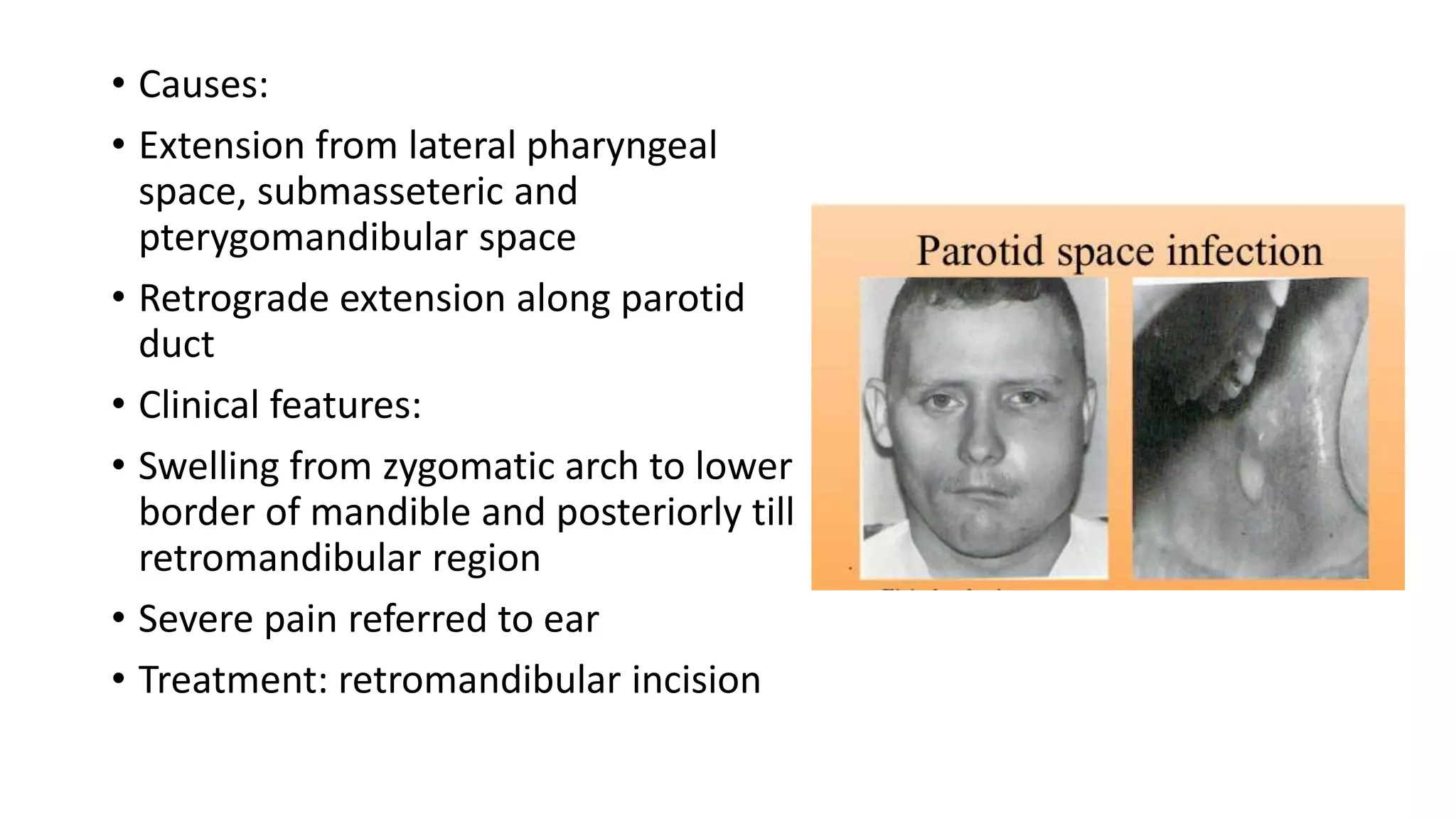 Fascial Spaces in the Head & Neck | PPTX