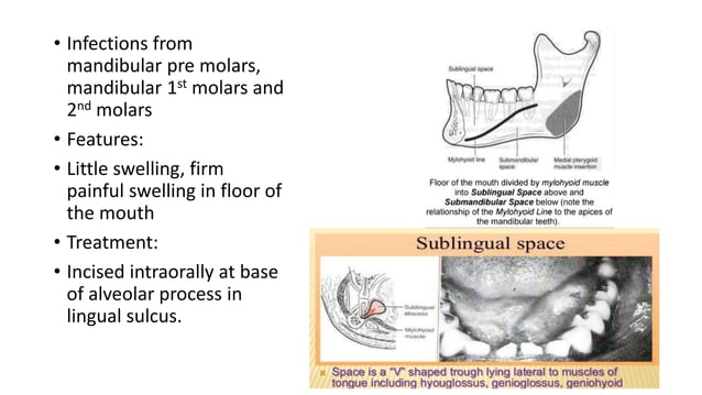 Fascial Spaces in the Head & Neck | PPTX