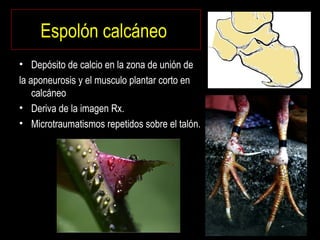 Fascia plantar | PPT