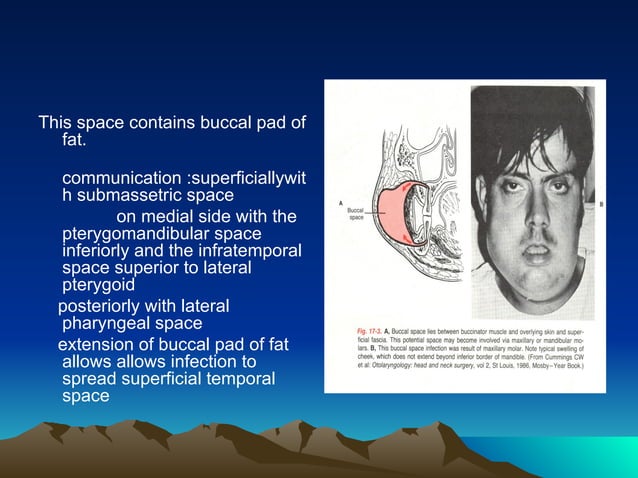 Fascias and fascial space infections of head and neck 1.ppt