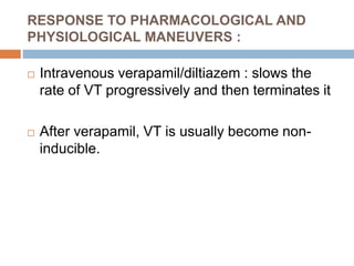 Fascicular vt chetan new | PPTX