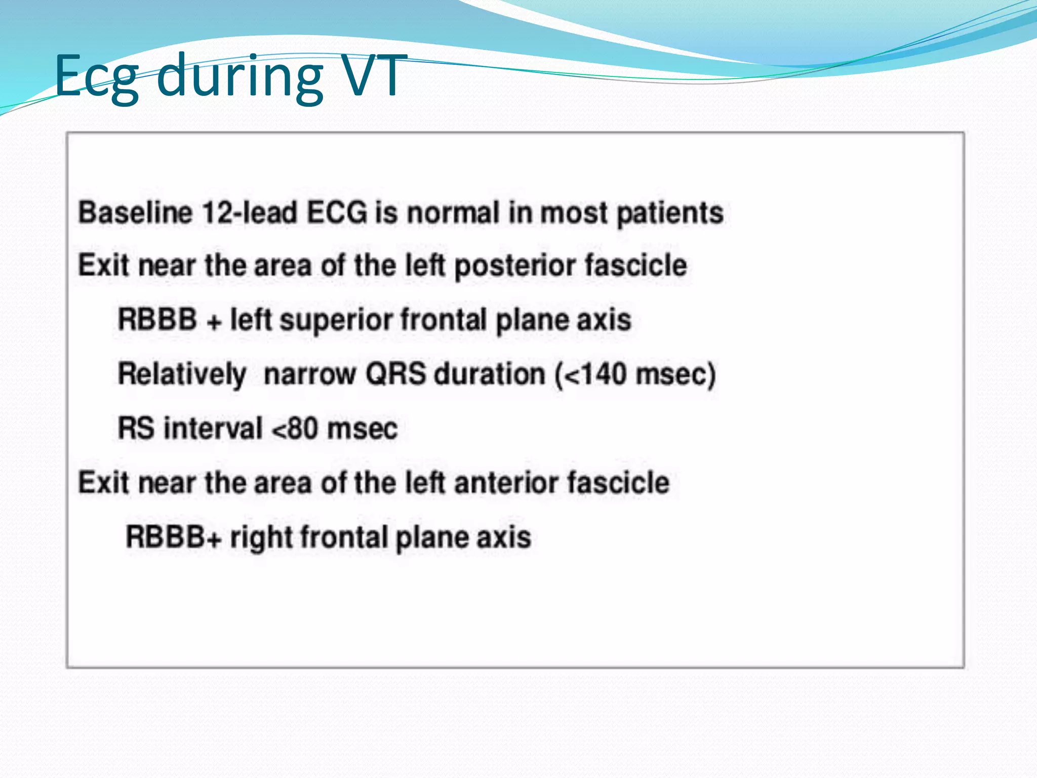 FASCICULAR VENTRICULAR TACHYCARDIA( VT) | PPTX