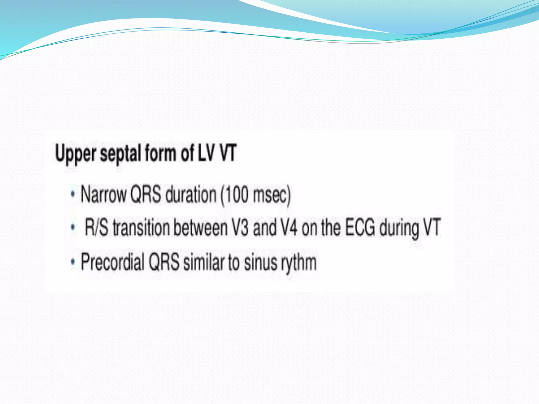 FASCICULAR VENTRICULAR TACHYCARDIA( VT) | PPTX
