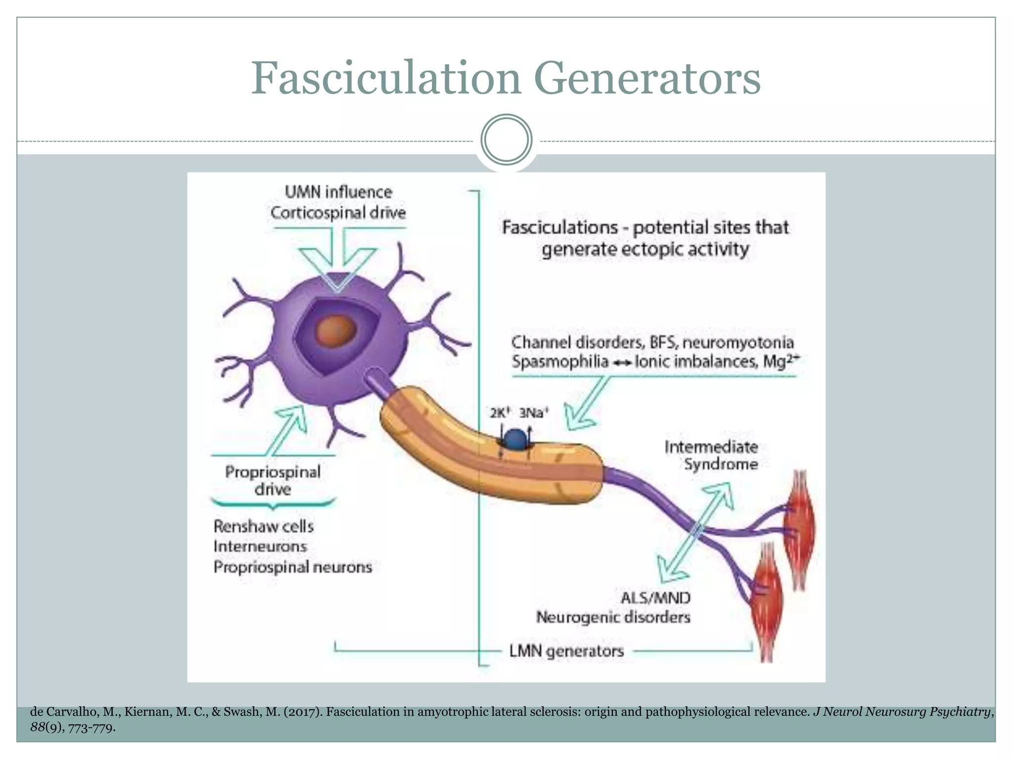 Fasciculation in Amyotrophic Lateral Sclerosis | PPTX