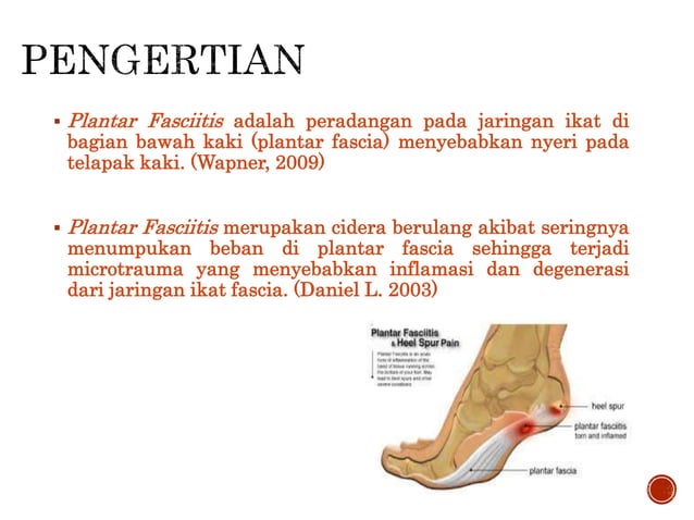Fasciitis_Plantaris_ProlanisAH23.pptx