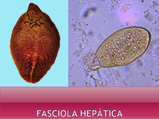 Fasciola Hepatica Cdc