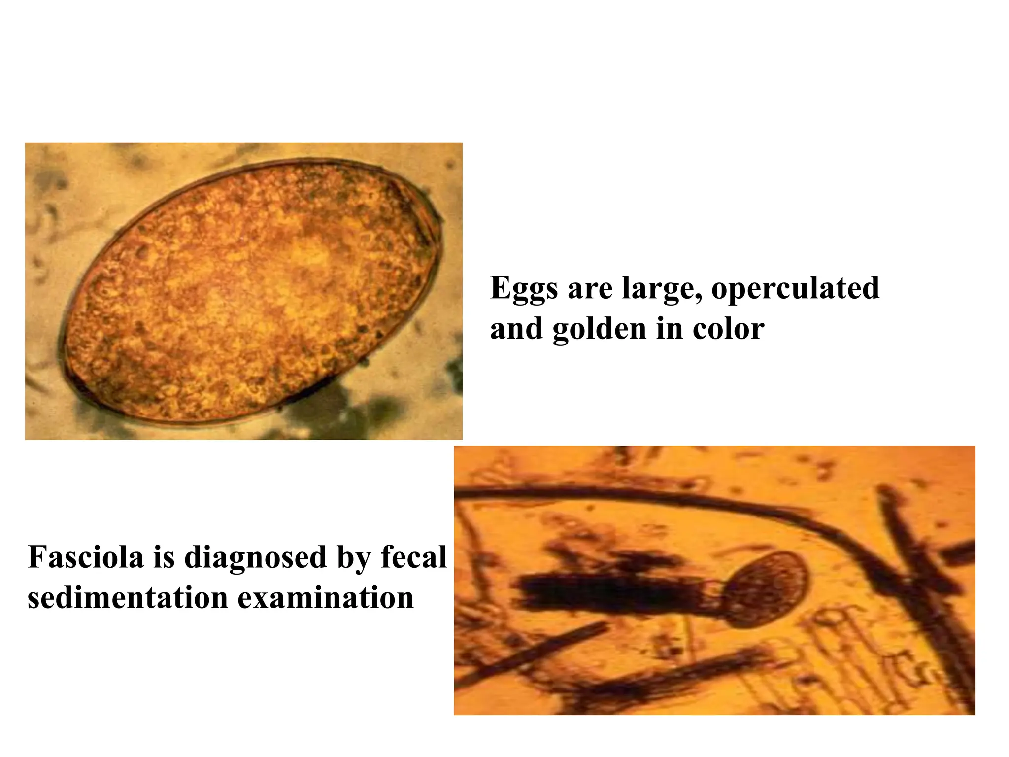 Fasciola Hepatica (Liver Fluke) and Gigantica | PPTX