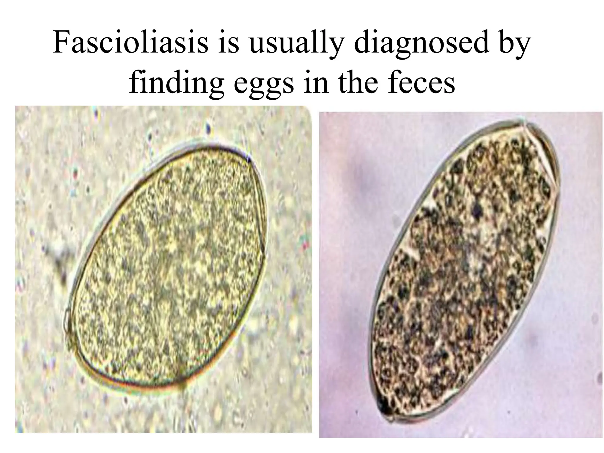 Fasciola Hepatica (Liver Fluke) and Gigantica | PPTX