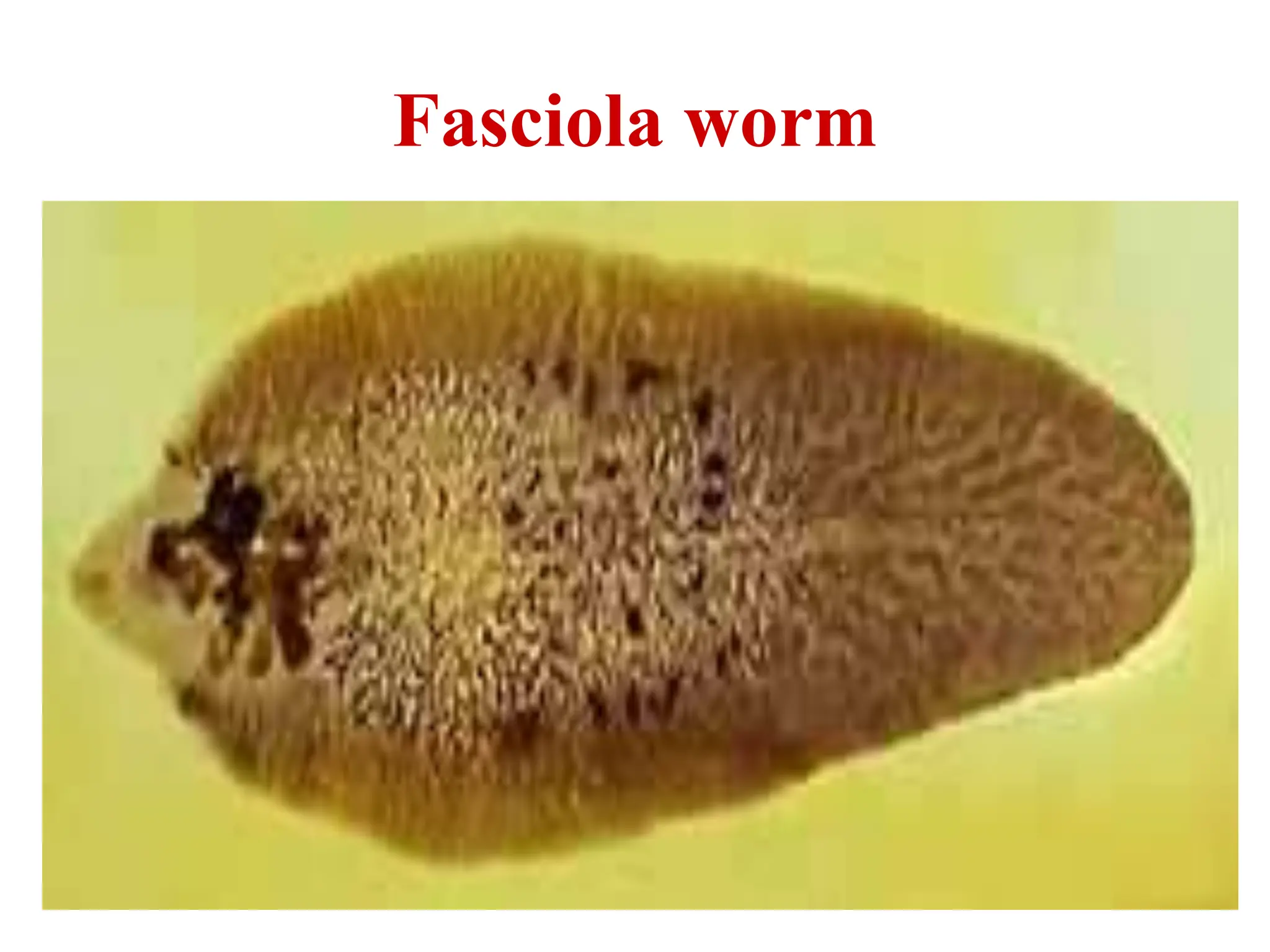 Fasciola Hepatica (Liver Fluke) and Gigantica | PPTX