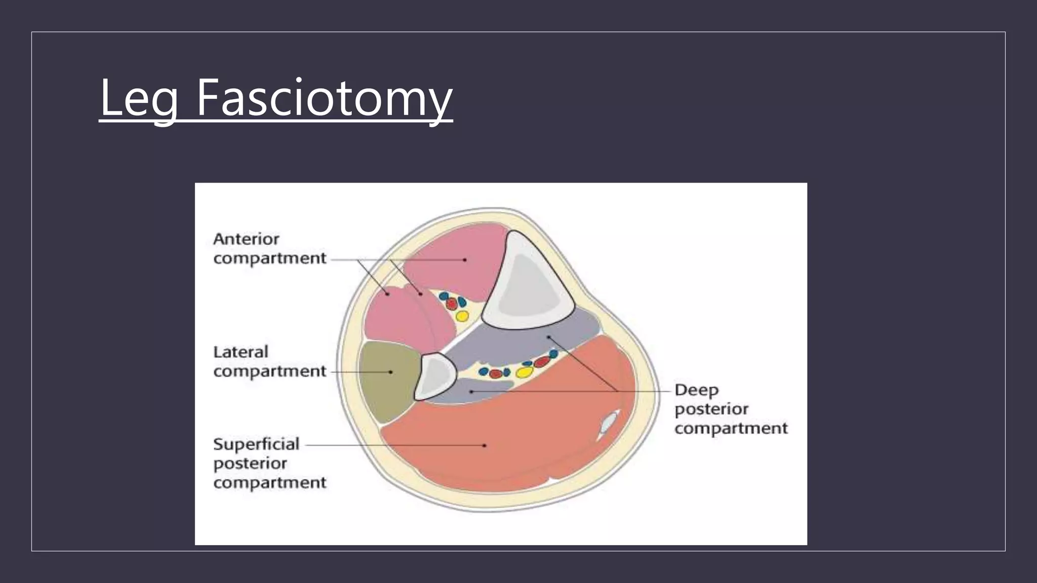 Fasciotomy & Escharotomy | PPTX