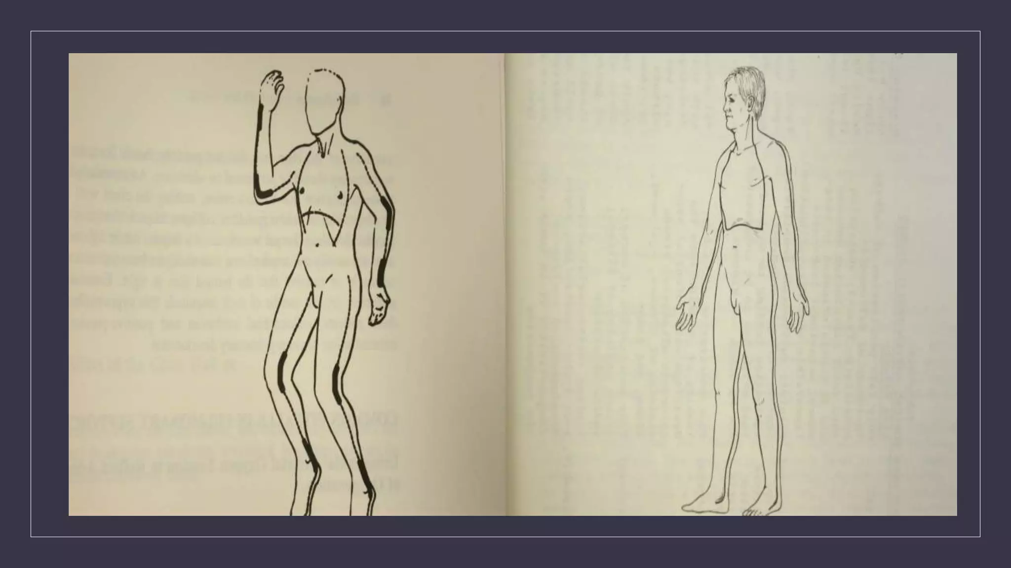 Fasciotomy & Escharotomy | PPTX