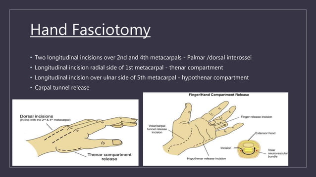 Fasciotomy & Escharotomy | PPTX