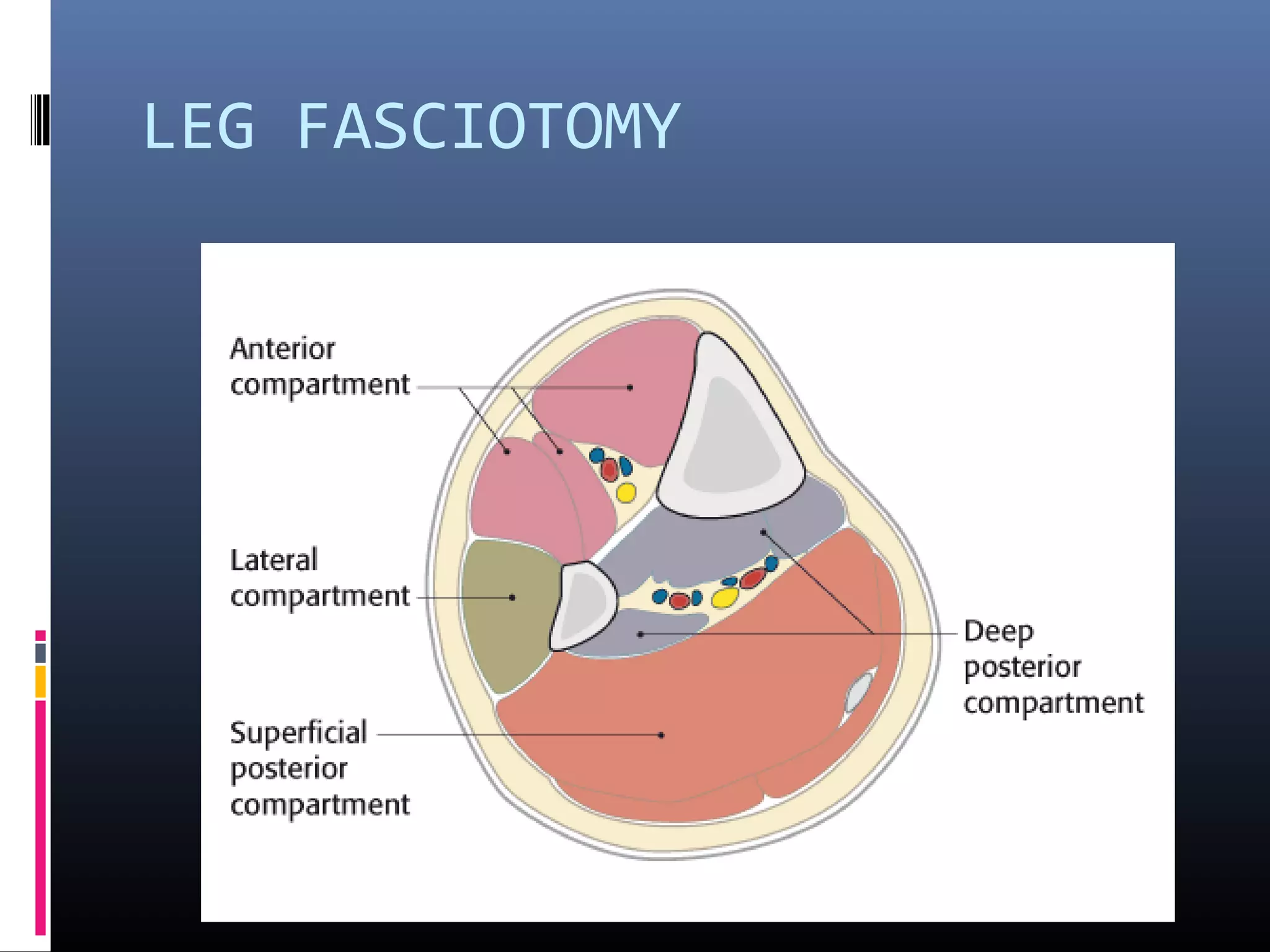 Fasciotomy | PPT
