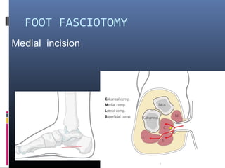 Fasciotomy | PPT