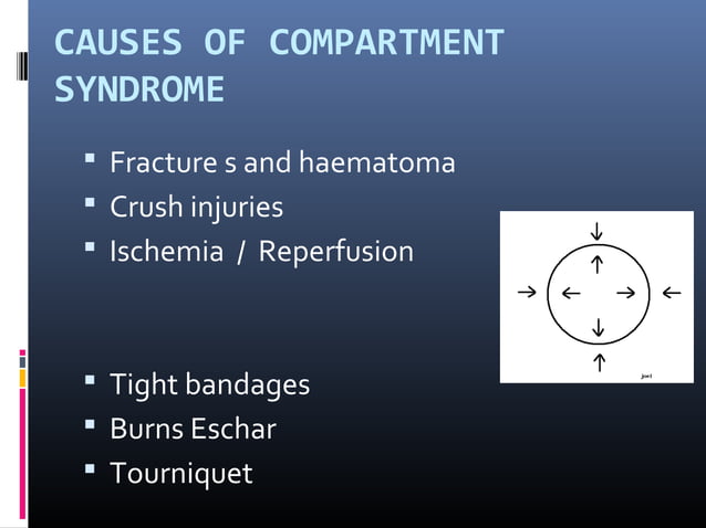 Fasciotomy | PPT