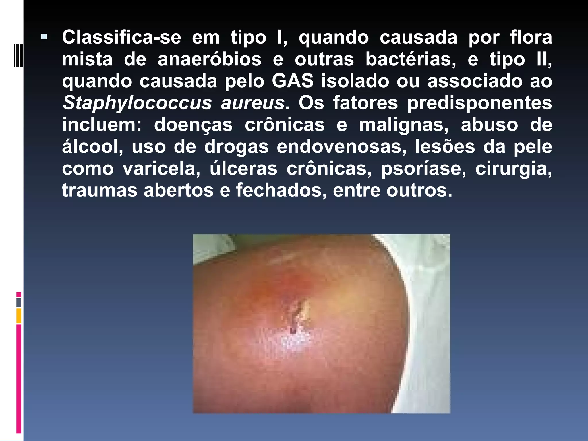 Fascite Necrosante Bacterias Comedoras De Carne | PPT