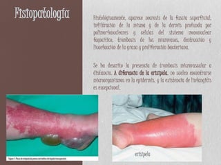 Fascitis Necrosante Pdf