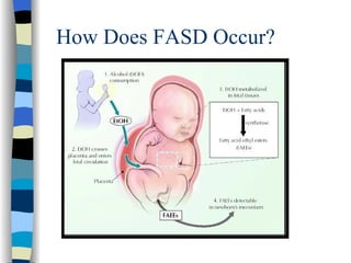 Fetal Alcohol Spectrum Disorder | PPT