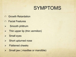 Fetal alcohol syndrome | PPTX