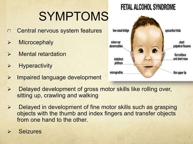 Fetal alcohol syndrome | PPTX | Pregnancy | Reproductive Health