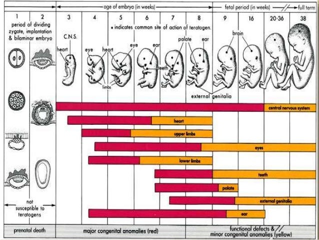 Fetal alcohol syndrome