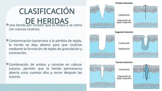 fases de cicatrizacion de las heridas.pptx