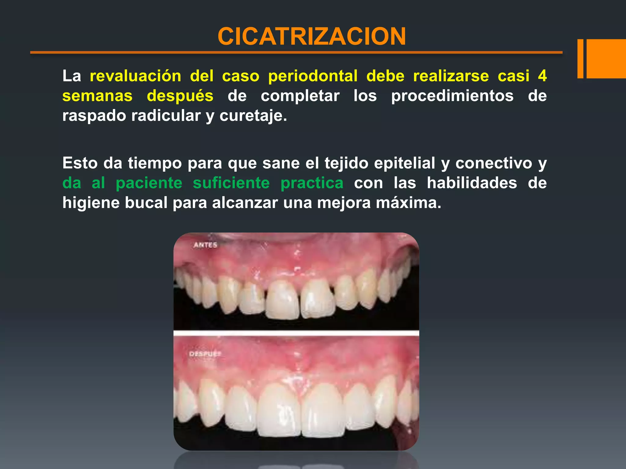 Fases del tratamiento periodontal, Carranza, Periodontología clínica ...