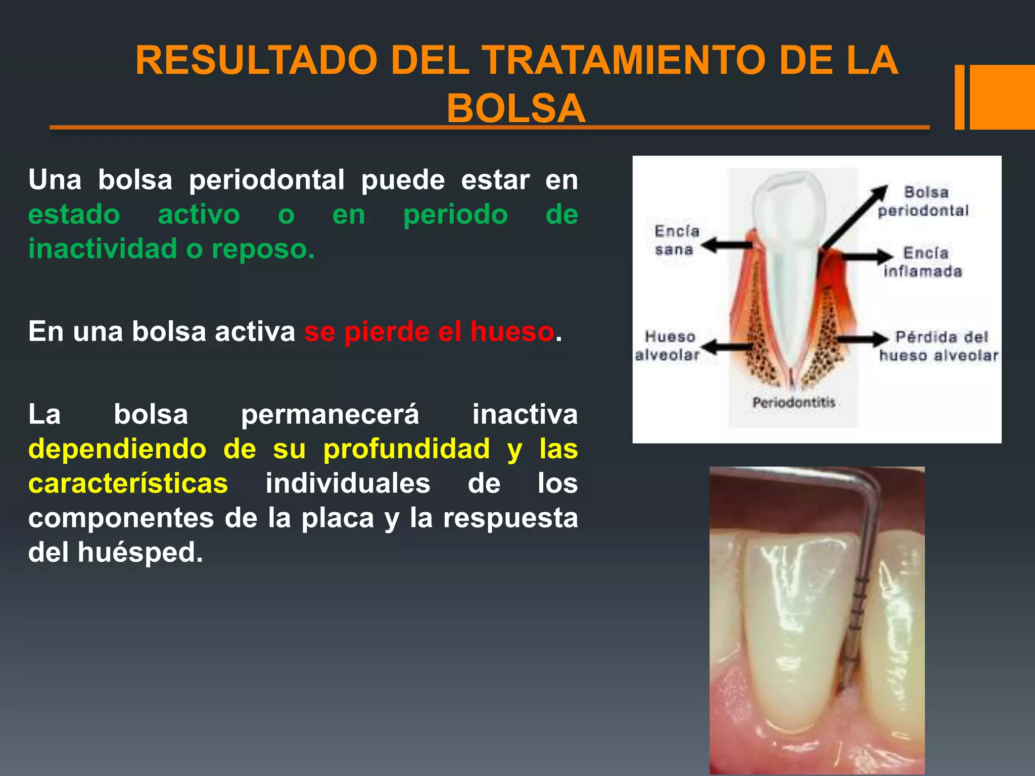 Fases del tratamiento periodontal, Carranza, Periodontología clínica ...