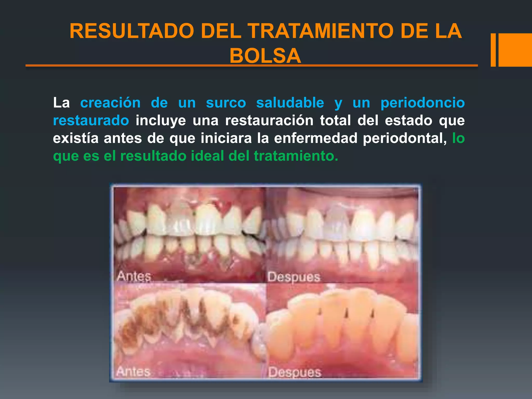 Fases del tratamiento periodontal, Carranza, Periodontología clínica, Décima edicion | PPTX