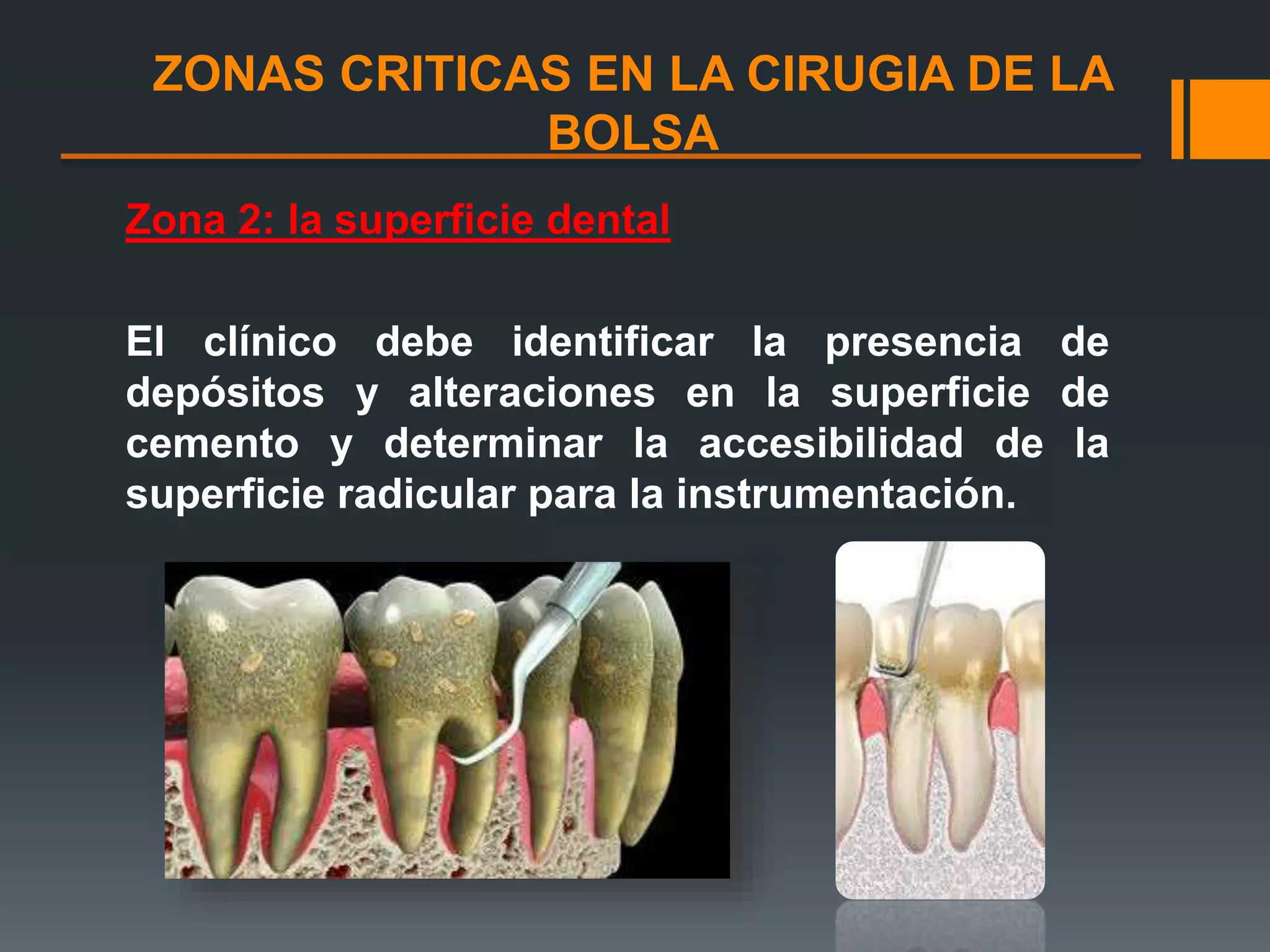 Fases del tratamiento periodontal, Carranza, Periodontología clínica ...